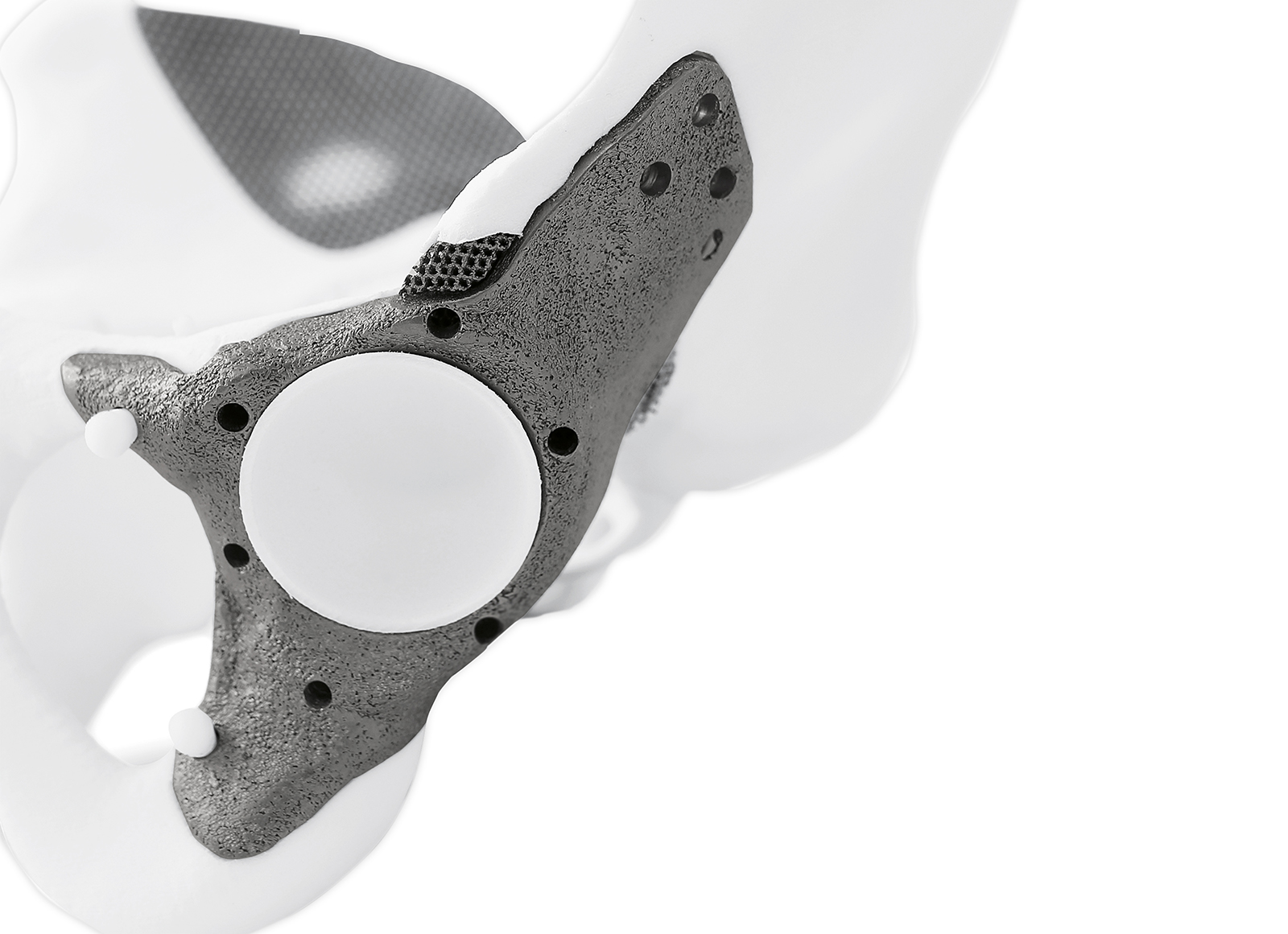 FIT AG: High-volume metal Additive Manufacturing