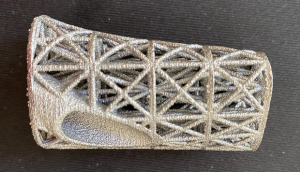 UK hospitals use metal Additive Manufacturing to save patient limbs